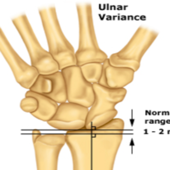 Distal Radius Fractures and Splinting — Kwak Talk