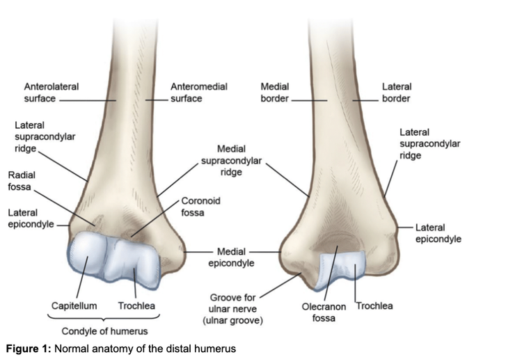 Distal Humerus Fractures — Kwak Talk