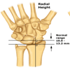 Distal Radius Fractures and Splinting — Kwak Talk