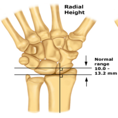 Distal Radius Fractures and Splinting — Kwak Talk