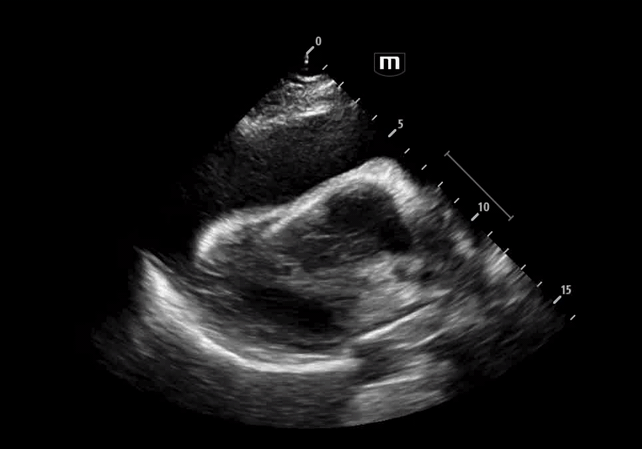 Is it Tamponade — Kwak Talk