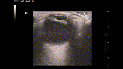 An ocular emergency? — Kwak Talk