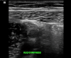 Appendix ultrasound — Kwak Talk