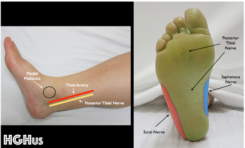 Posterior Tibial Nerve and Sural Nerve Block — Kwak Talk