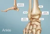 Ankle Fractures — Kwak Talk