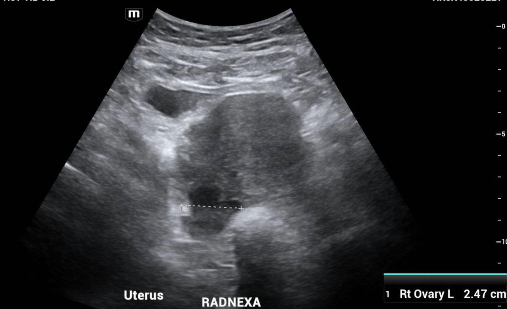 Ectopic POCUS — Kwak Talk