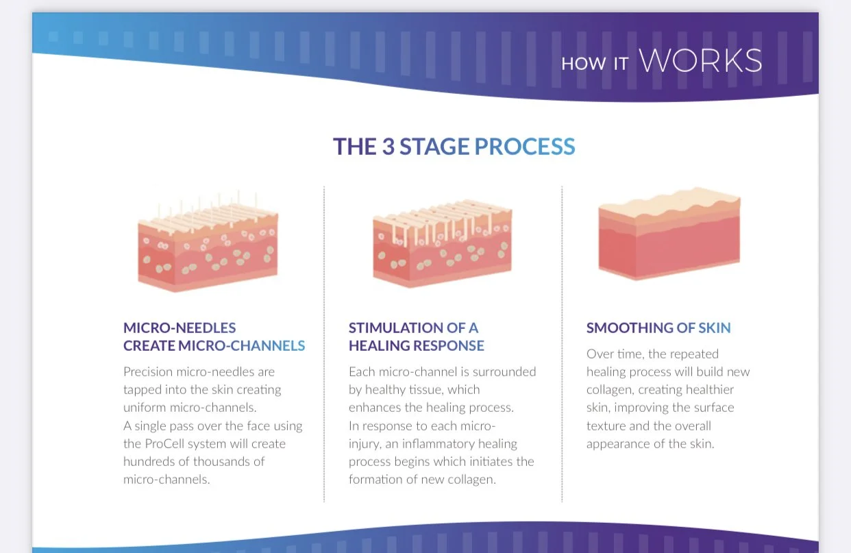 Procell Microchanneling — hannah brie esthetics