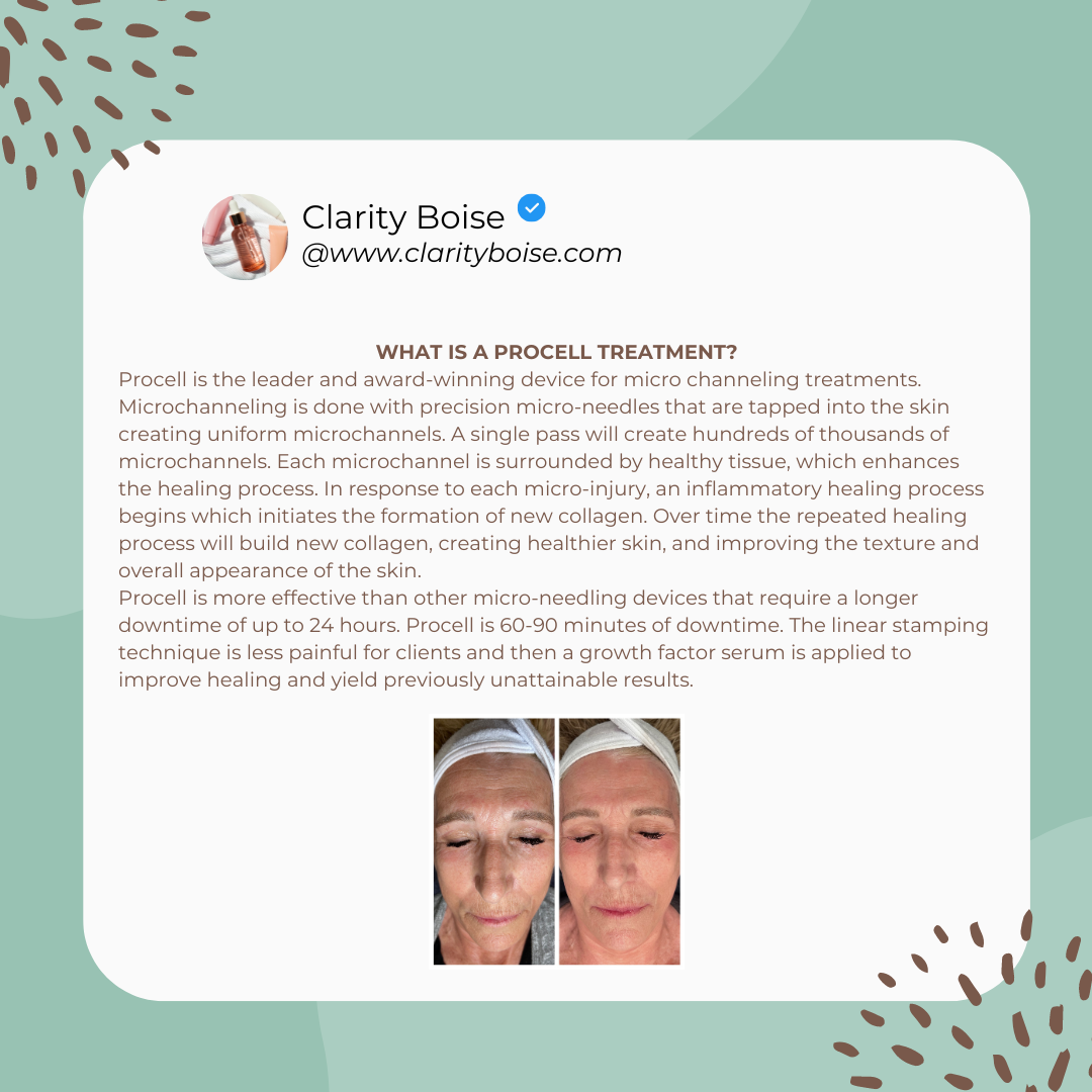 Latest News — hannah brie esthetics