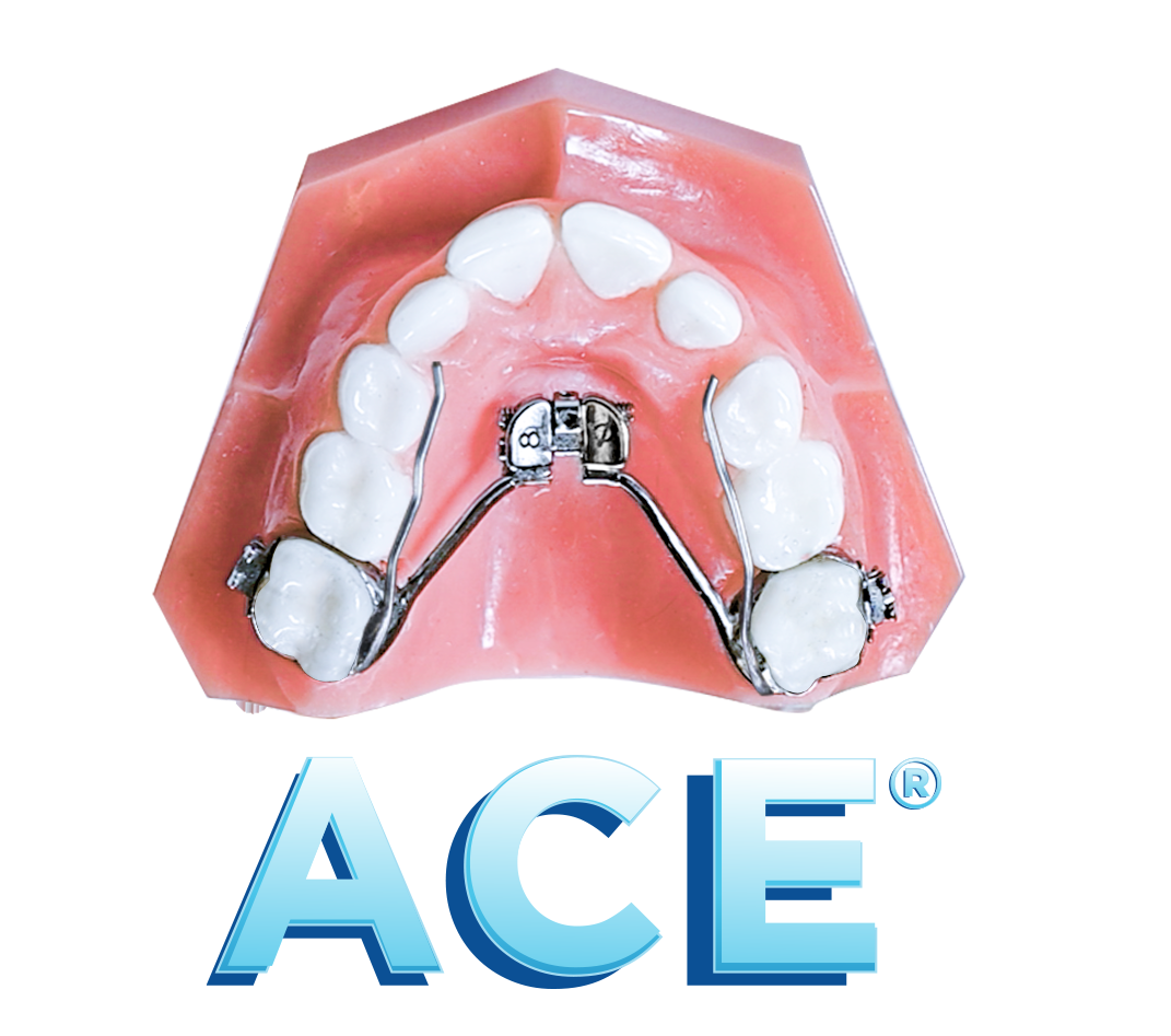 Expanders — Mixed Dentition Orthodontics