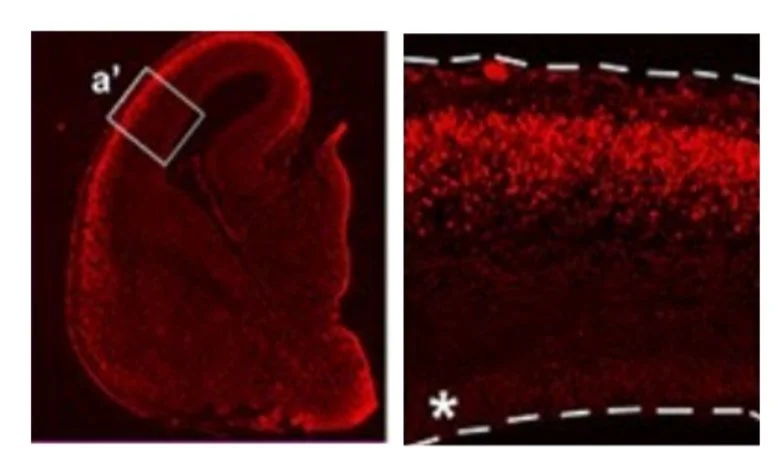 The FOXG1 Research Foundation is providing rolling grants to scientists ...