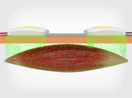 Body Contouring: TruSculpt id & Flex — Venustas Immortalis