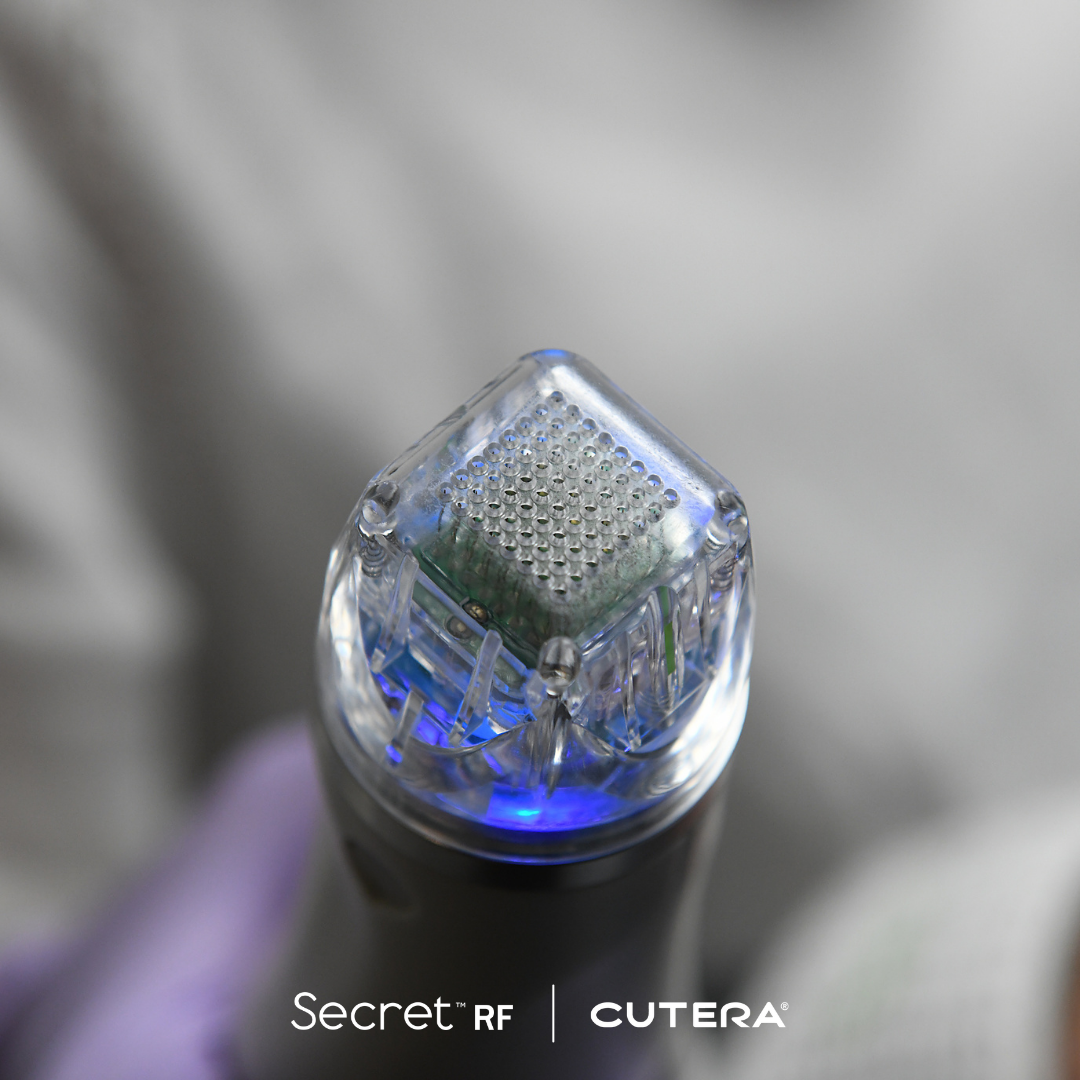 Body Contouring for a Sculpted Shape | Serving Janesville, New Glarus & Dubuque — Venustas ...