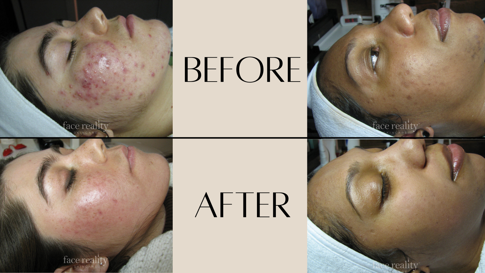 Middletown, DE Private Luxury Spa For Results-Driven Treatments ...