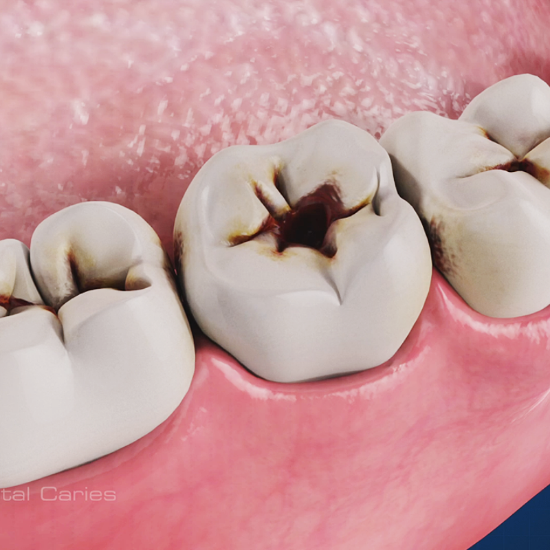 Dental ABC — Elite Care Dental