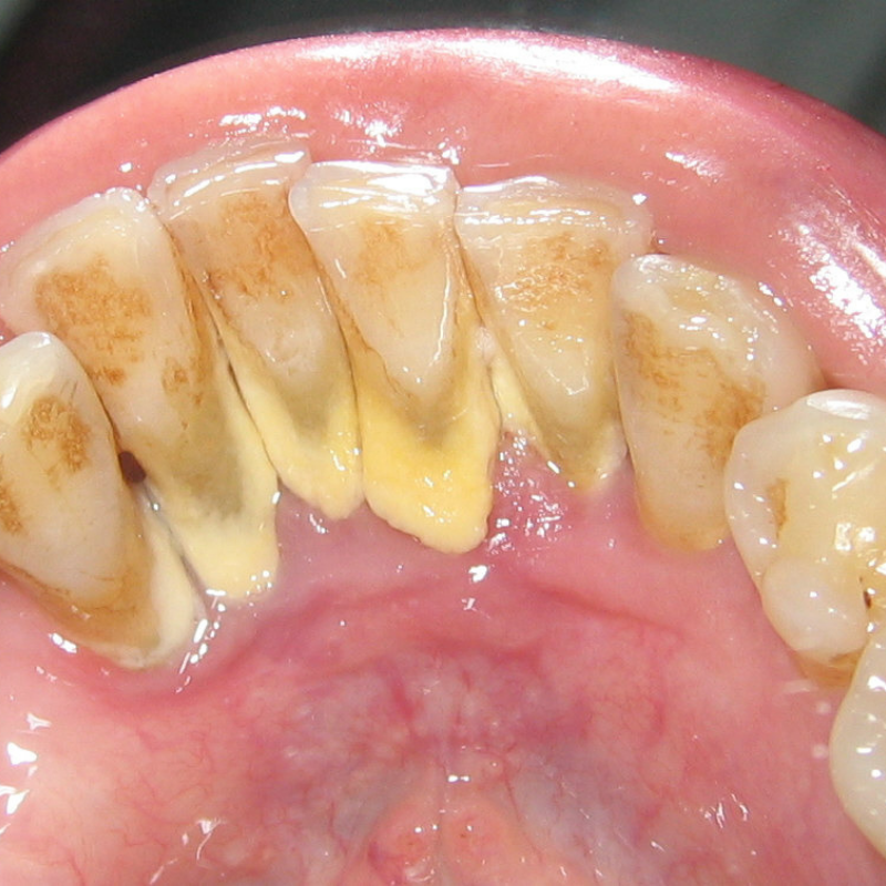 Dental ABC — Elite Care Dental