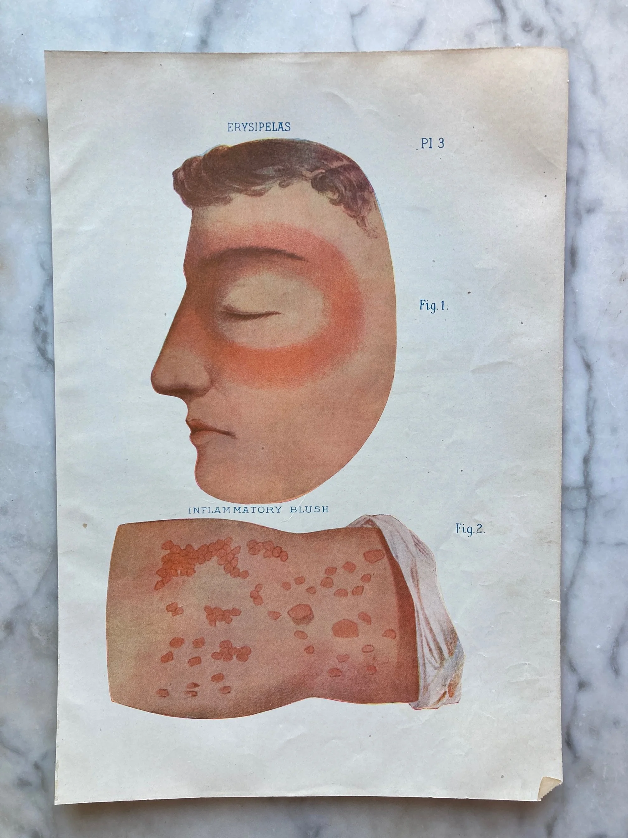 Antiques & Collectibles — Morbid Anatomy