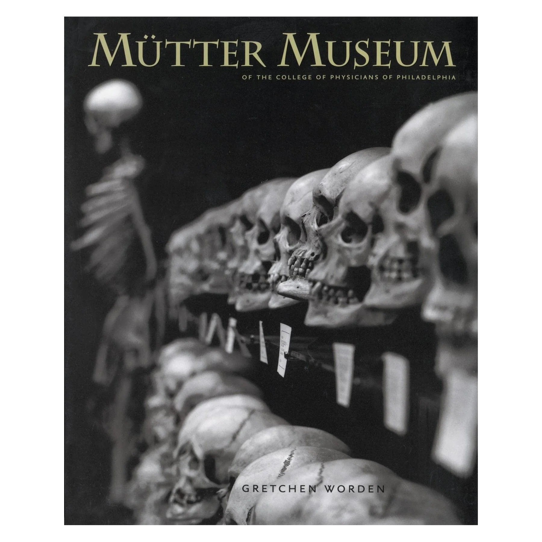 Mutter Museum Giant