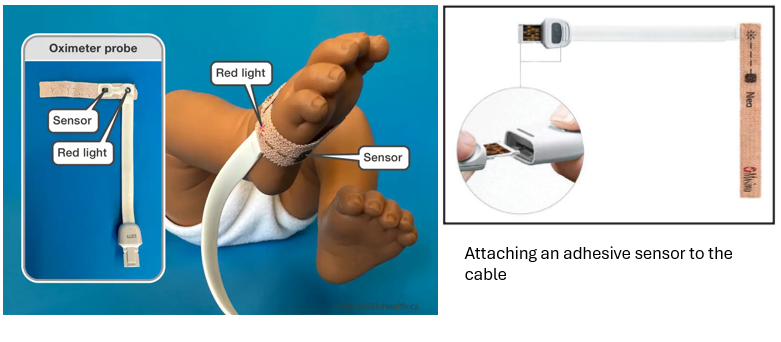 ALERT: How to maintain the cables and sensors (probes) of Masimo pulse ...