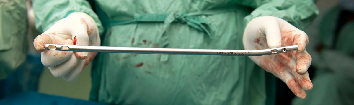 SIGN Products — SIGN Fracture Care International