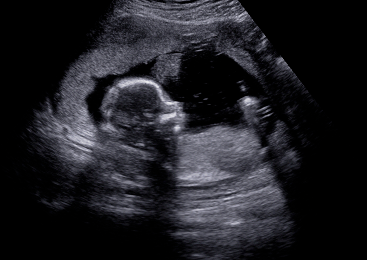 Toccoa Life Family Resource Center