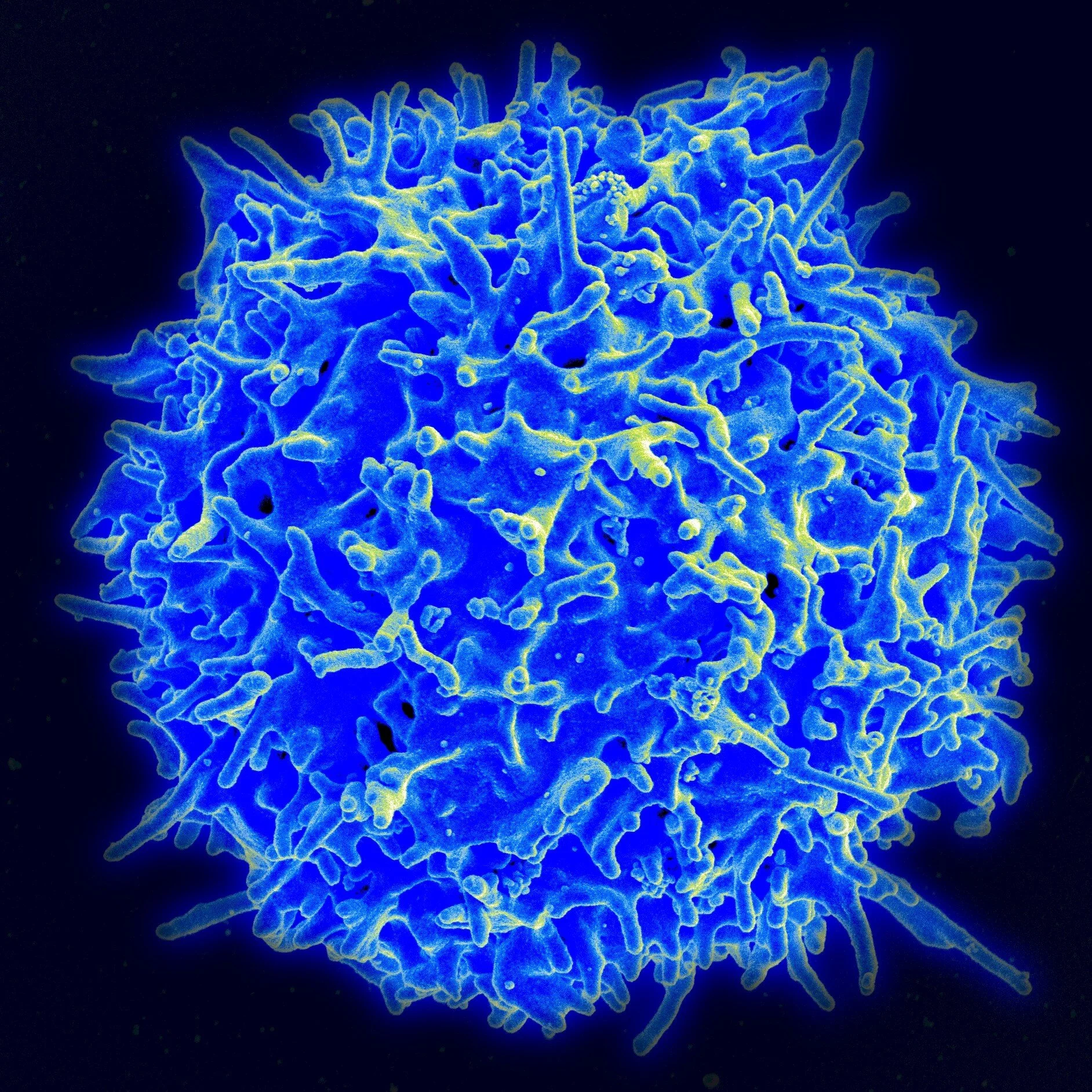 EsoBiotec Ready To Transform Cell Therapy Cancer Treatments Thuja esobiotec-ready-to-transform-cell-therapy-cancer-treatments-thuja