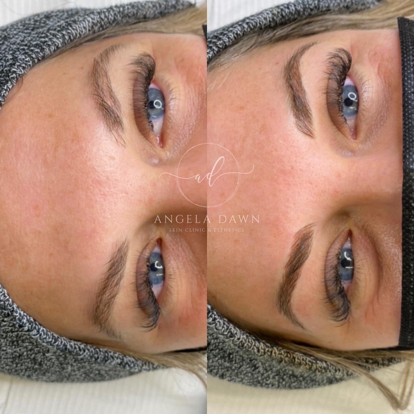 Microblading — Angela Dawn Aesthetics & MediSpa