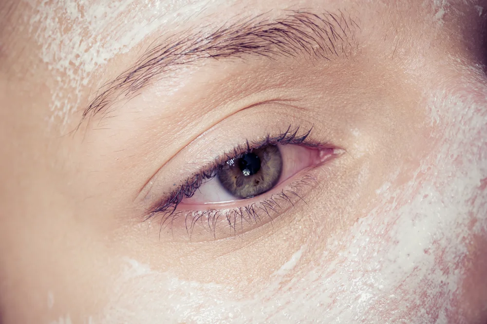 Causes of Uneven Eyes and Its Treatment