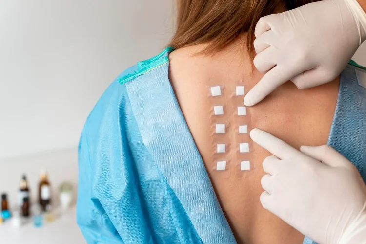 Understanding the Importance of Allergy Testing