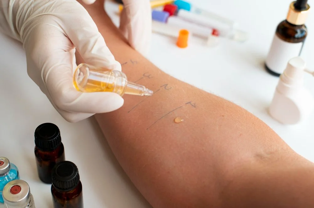 What to Expect from Allergy Testing and How to Navigate it