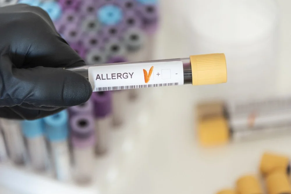 Allergies? Test Your Limits: Allergy Testing in the U.S.