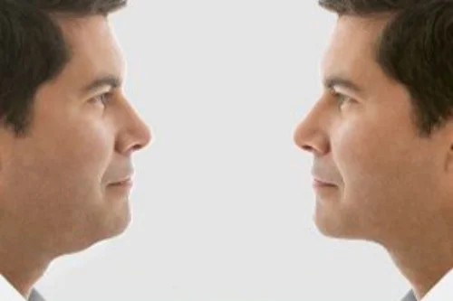Belkyra™ Calgary | Double Chin Treatment In Calgary — Britannia Dermedics