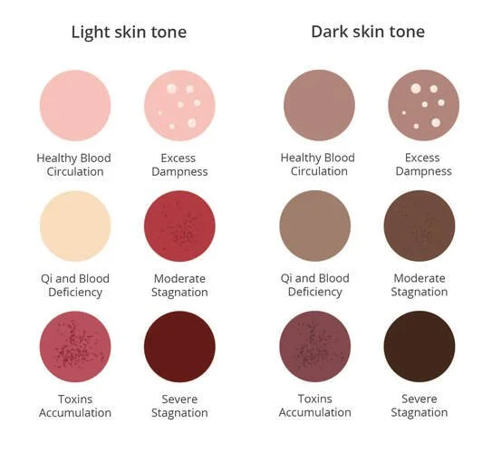 Chinese Cupping Chart A Comprehensive Guide To Chinese Medicine