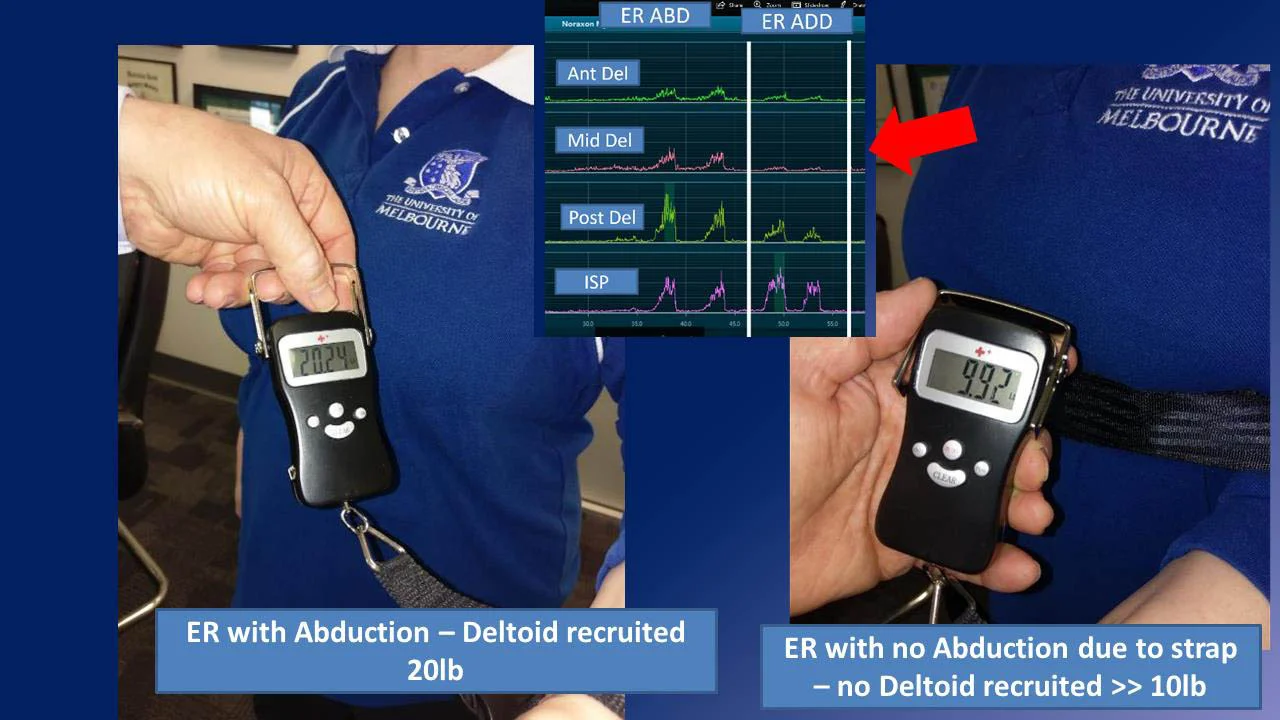 Wakefield Shoulder Program — Wakefield Shoulder Clinic