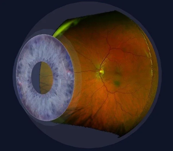 Ultra wide-field imaging of your eyes. — Eyevista Optometry - Making ...