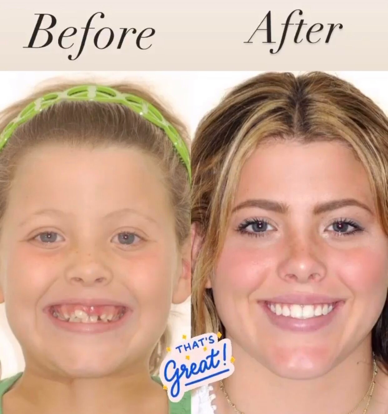 Why Phase 1 Orthodontic Treatment Matters — Lemchen Salzer Orthodontics ...