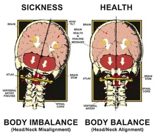 NUCCA Chiropractic: My Experience — Amanda's Health Journal