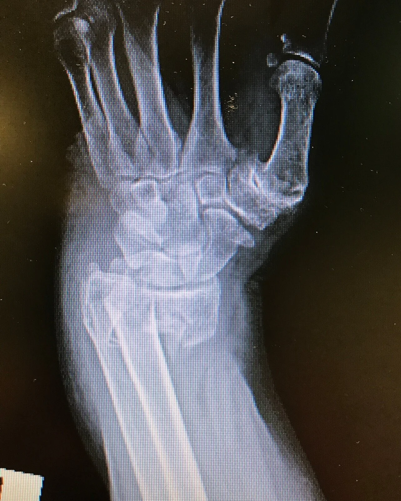 Hand Therapist Auckland | Hand Physio - The Hand Therapy Group