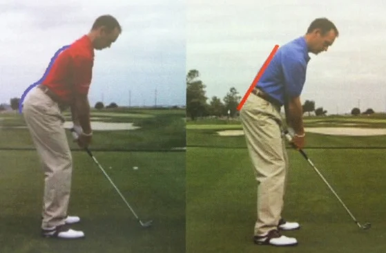 Lower Crossed Syndrome revisited — PAR5 Physical Therapy