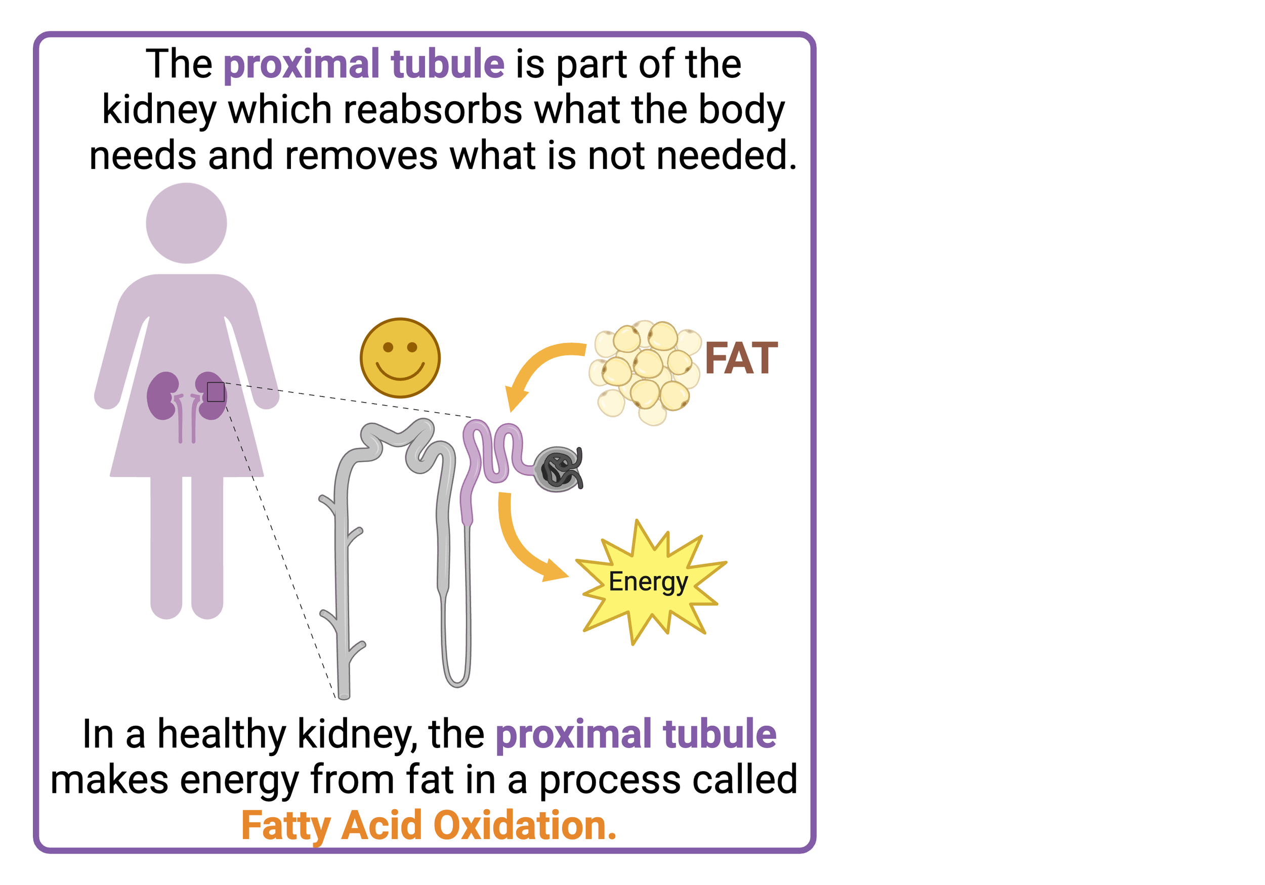 How Fat in Your Kidneys Can Lead to Kidney Disease — Penn Science ...