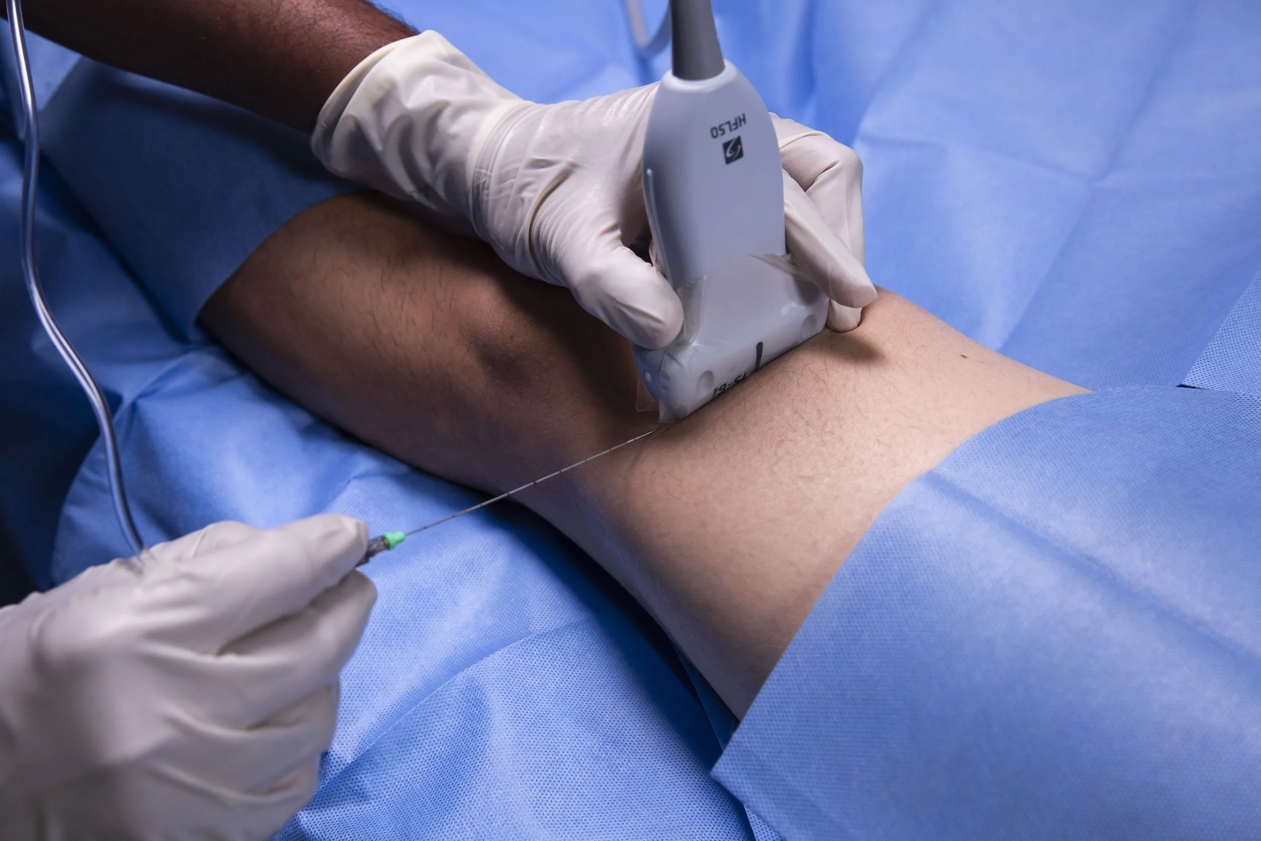 SynoJoynt — TampaPainMD