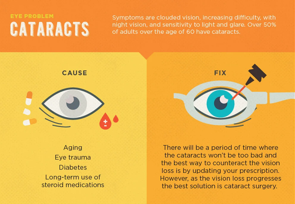Traumatic Cataract Symptoms Traumatic Cataract Symptoms