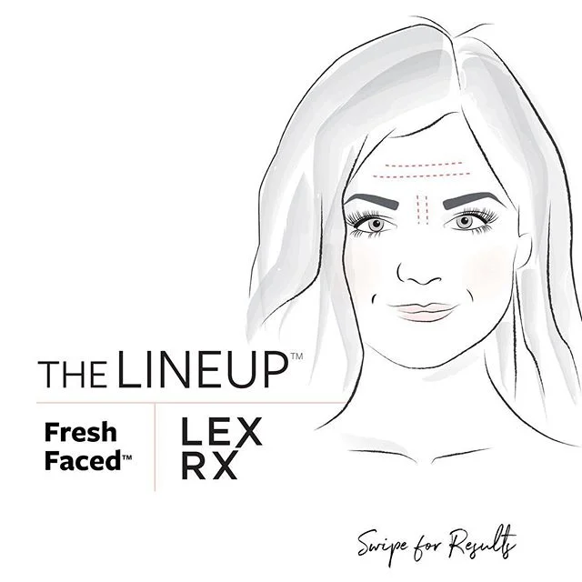 LexRx | Boston’s Best Botox and Dermal Filler Practice