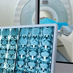 Patient Preparation | Radiology Associates Imaging — Radiology ...