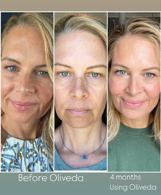 Discover the Power of Waterless Skincare with Oliveda — Angie Bloom