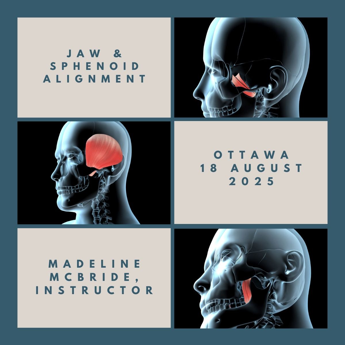 JAW & SPHENOID ALIGNMENT — McBride Pain Clinic