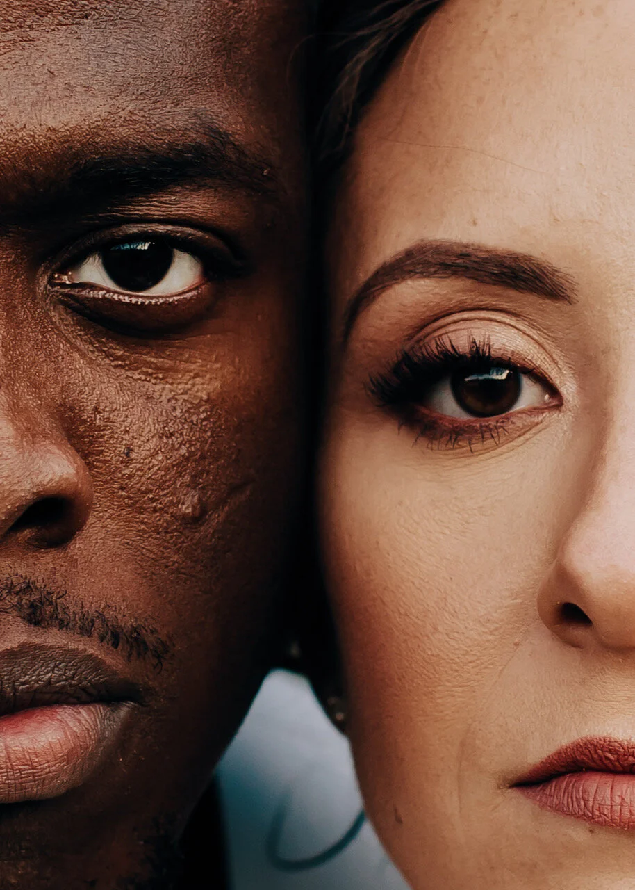 Yellowish Brown Skin