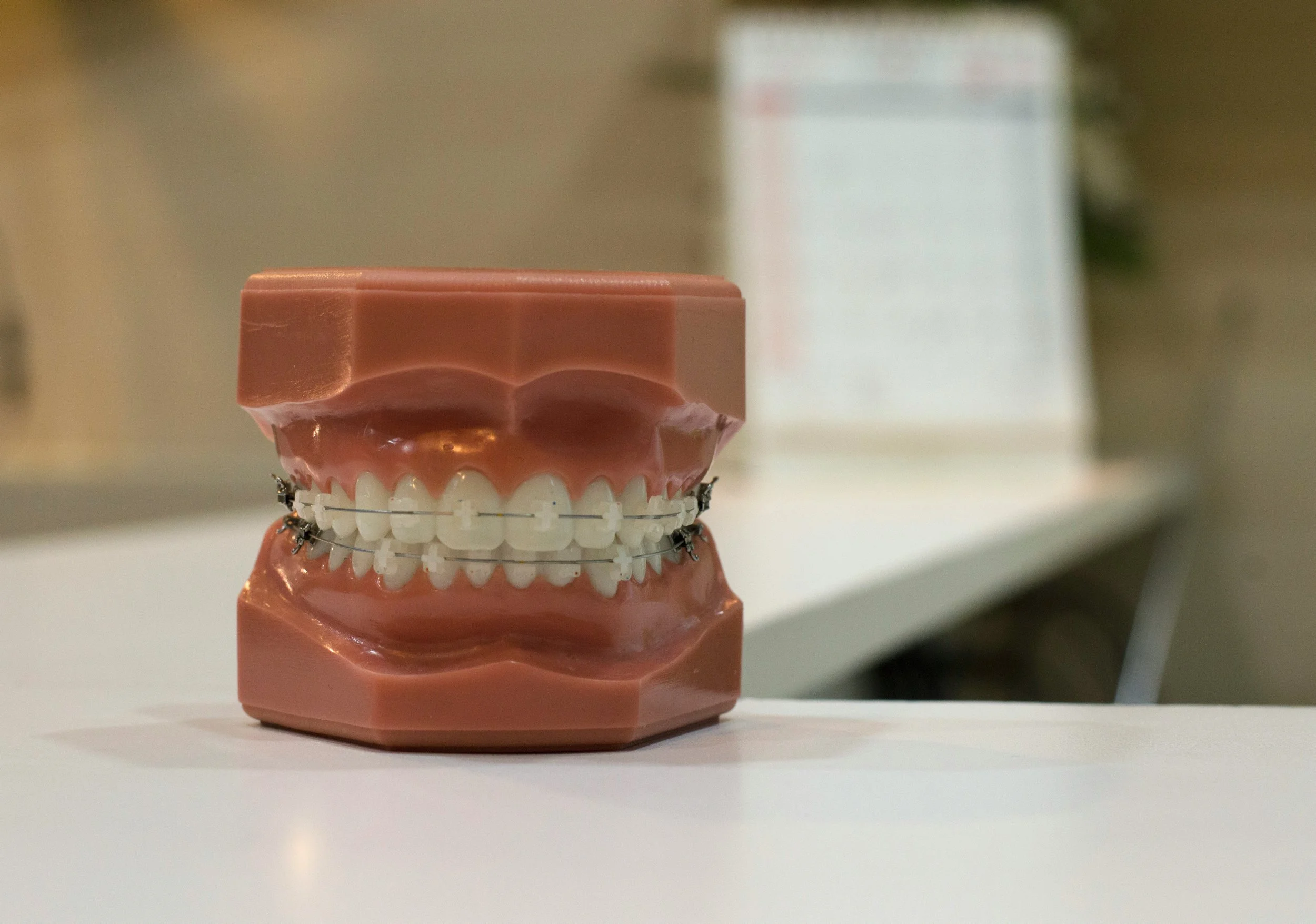 What Is a Dental Arch? | Blauer Family Dental • Blauer Family Dental in ...