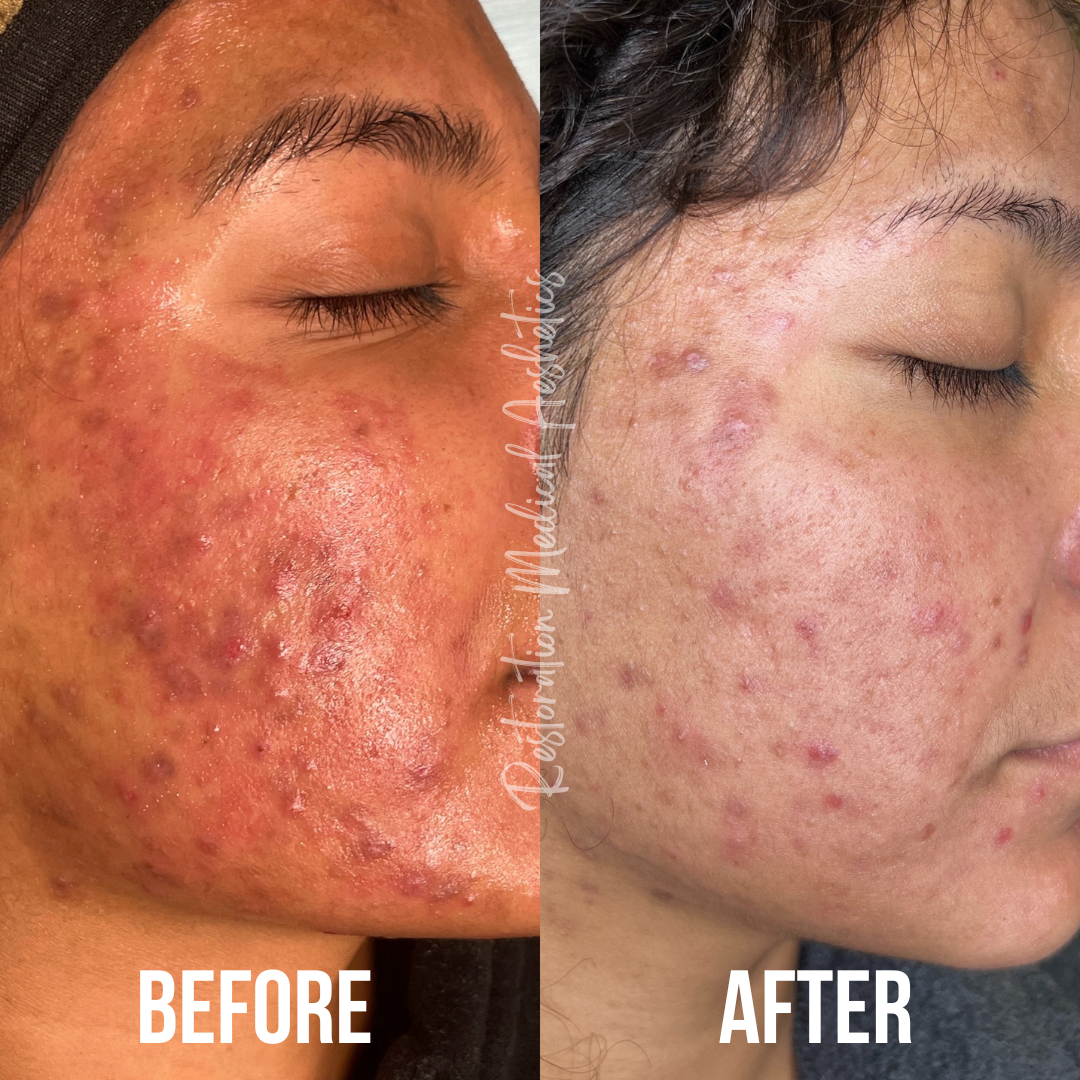 Agnes — Restoration Medical Aesthetics