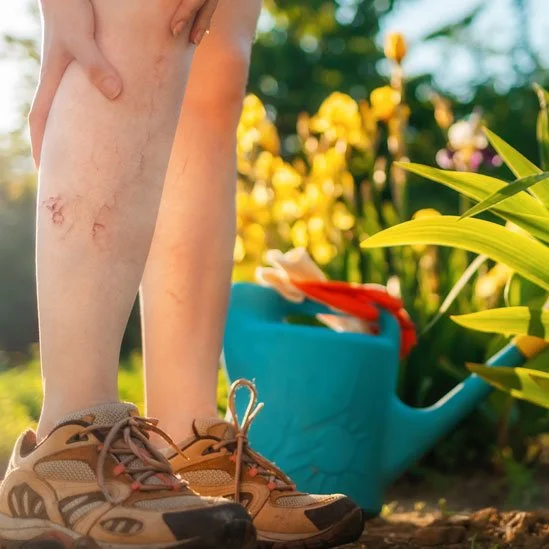 How Does Weather Affect Your Veins? — Physicians Vein Clinics