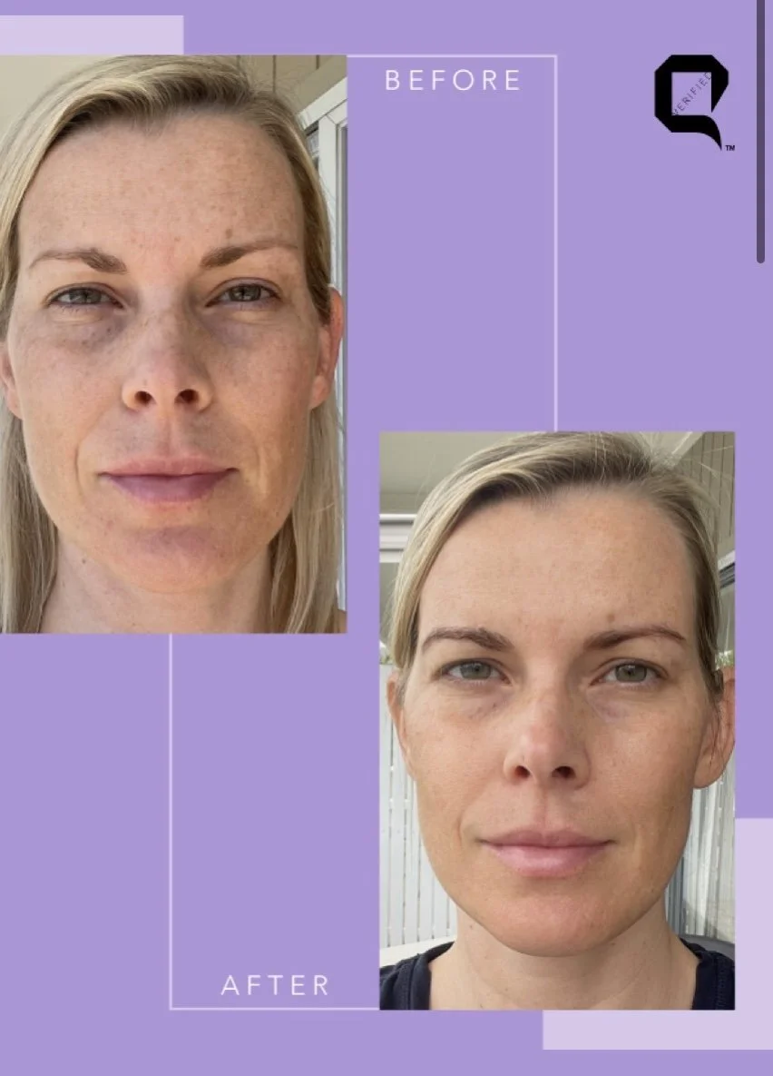 How Long Does it Take for Liquid Collagen to Work? — More than Mom